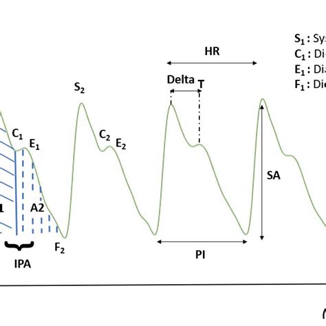 A The Three Phases Of The Photoplethysmography Ppg Signal Download Scientific Diagram