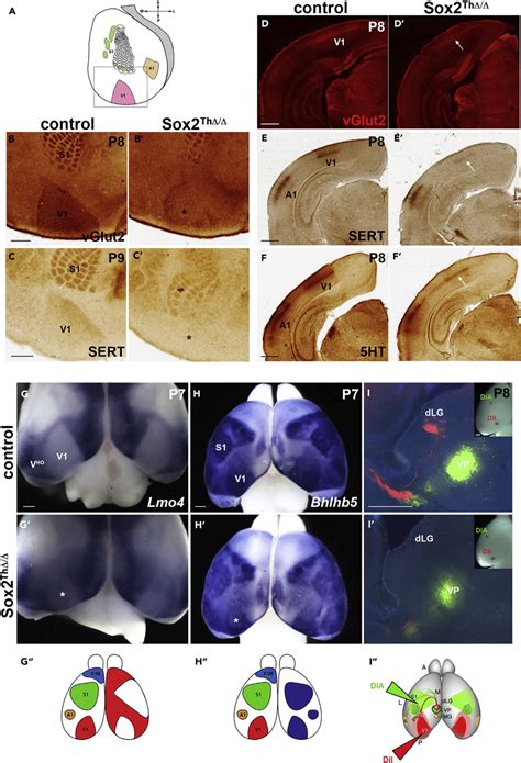 Thalamo Cortical Connectivity And Cortical Patterning Are Abnormal In Download Scientific