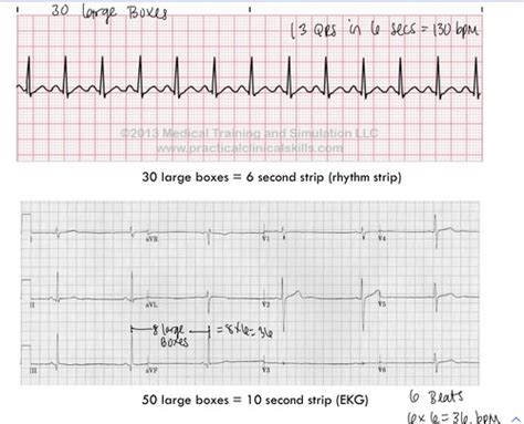 Heart Rate Calculation Amy Flashcards Quizlet