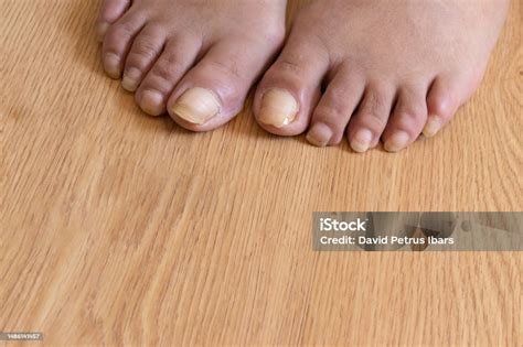 길고 더럽고 부주의한 손톱을 가진 성숙한 중동 여성의 발 개인 그루밍과 페디큐어의 개념 50 54세에 대한 스톡 사진 및 기타 이미지 50 54세 개념 개성 개념