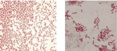 Lecture 5 8a Pseudomonas Haemophilus Flashcards Quizlet