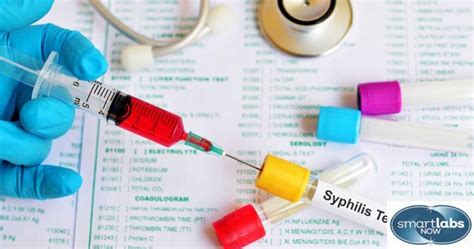 RPR Test Explained Purpose And Procedure