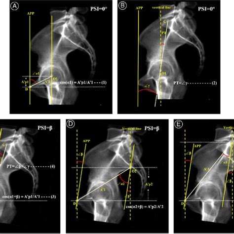 Differences And Correlation Between EPSI And APSI Download Scientific Diagram