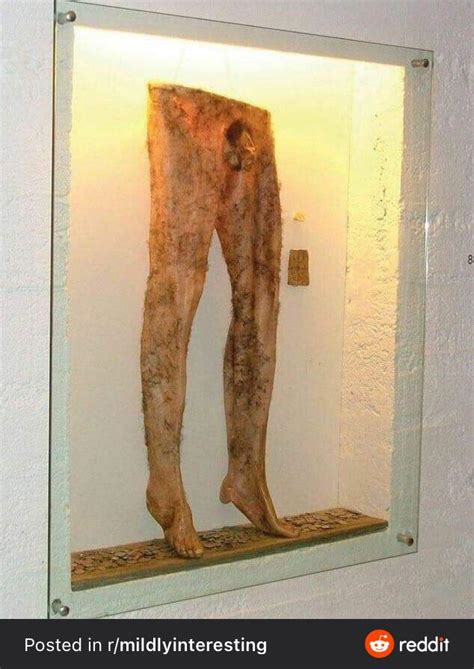 Flayed Skin