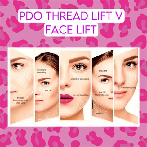 Pdo Thread Lift Revolutionary Non Surgical Face Lift Beauty By Laura Jayne