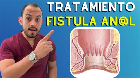 Presión Rectal Causas Diagnóstico Y Tratamiento Qcujpi