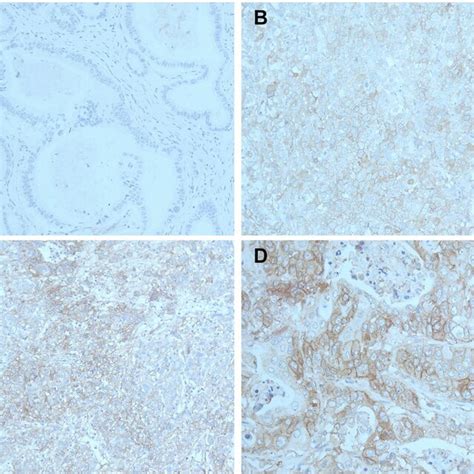 Immunohistochemistry Staining For Integrin Beta1 Itgb1 Negative