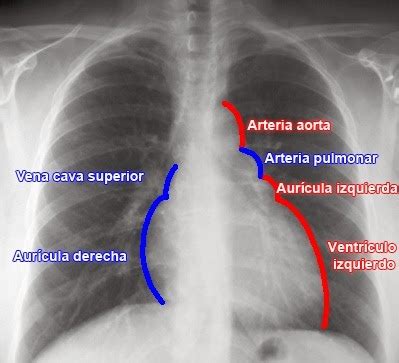 Tecnicos Radiologos Todo Sobre La Obtención Y Lectura De Radiografía