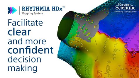 Boston Scientific Cardiology On Linkedin Rhythmia Hdx™ Mapping System
