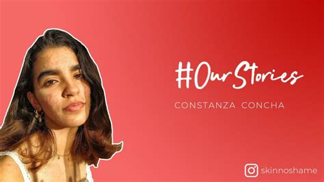 In Conversation With Skin Positivity Influencer Constanza Concha