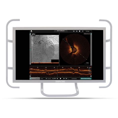 Optis™ Integrated System