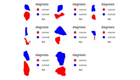 Spamtp Spatial Metabolomics Analysis • Spamtp