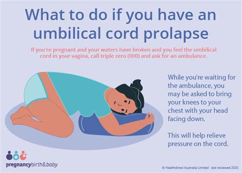 Prolapsed Cord Emt