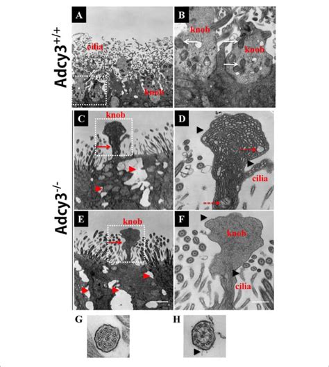 Investigating Disruption Of Cilium Ultrastructure In P30 Adcy3 − − Download Scientific