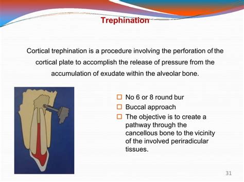 Endodontic Surgery Ppt