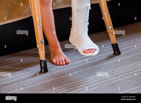 Gebrochenes Bein In Gips Der Unkenntlich Kleines Kind Junge Mädchen In