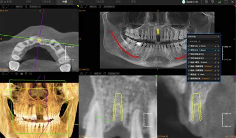 Ai正在重塑牙科诊疗模式 Kq88口腔新闻