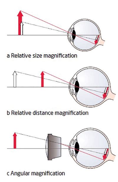 Optician Online Cpd Archive