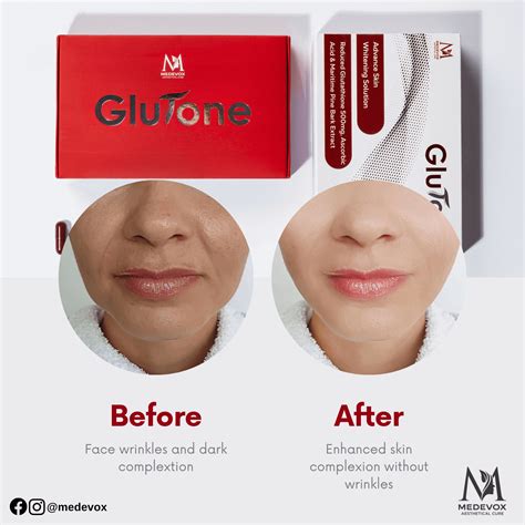 Glutone 30 Capsules For Anti Aging Glowing And Healthy Skin