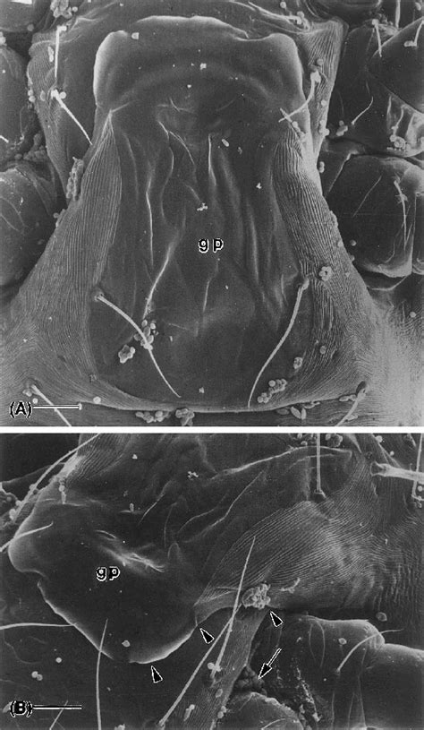 SEM Of Female Genital Structures In Ph Persimilis A Ventral View Of Download Scientific