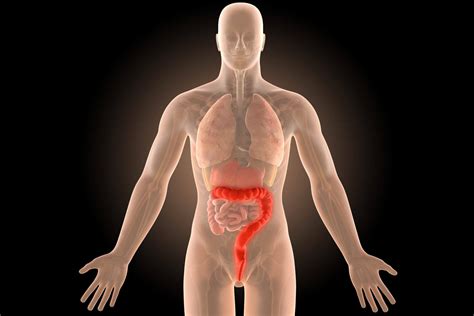 Managing Ulcerative Colitis Improves Patient Reported Outcomes Despite