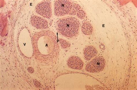 Nerve Cross Section Slide Labeled Cross Sectional Anatomy Of A