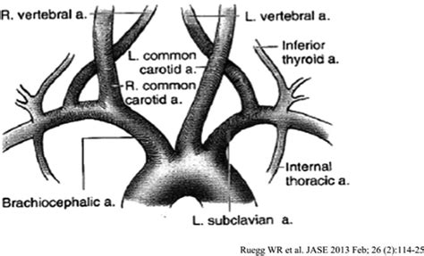 Schematic Diagram Showing The Aortic Arch Anatomy The Usual Anatomy Of