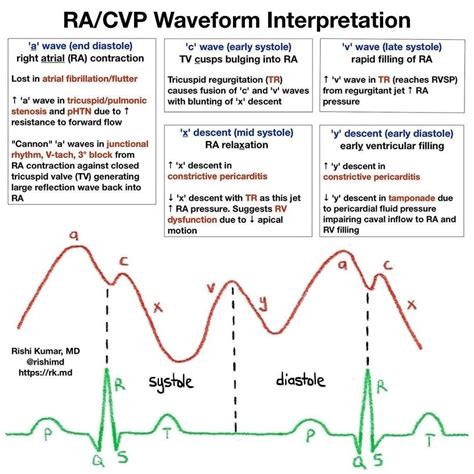 The Heart 🔴 Racvp Waveform Interpretation⤵️ 🔹central Venous Pressure
