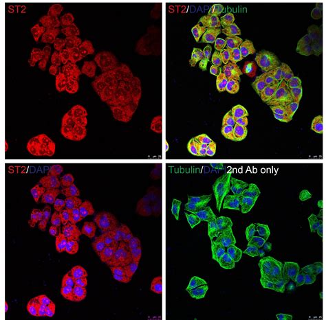 St2 Antibody Cat No 3363 Prosci