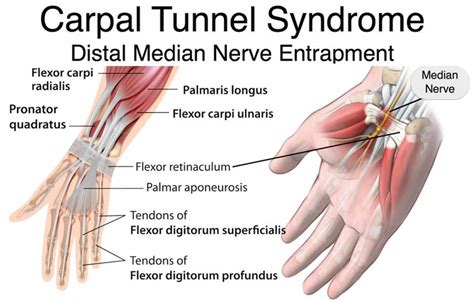 Tinel Sign Definition Tinels Sign Test And Positive Tinel Sign