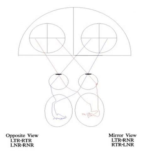 Visual Training And Perception Glasses Hubpages