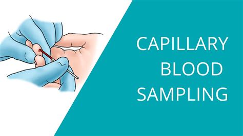How To Fill A Capillary Tube At Oliver Silas Blog