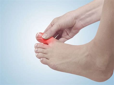 6 Important Sprained Toe Symptoms You Must Know