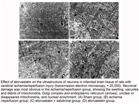 Salubrinal Selective Eif2 Inhibitor For Cell Signaling Apexbio