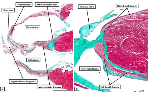 Atrioventricular Node