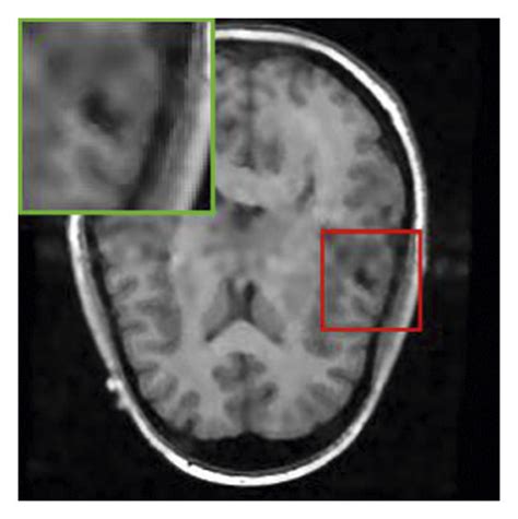 An Example Of Cartoon Texture Decomposition Of Fctd And Ifctd C Download Scientific