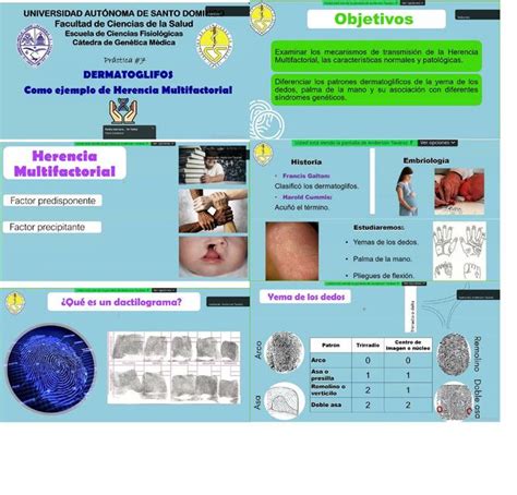 Herencia Multifactorial Meri Udocz