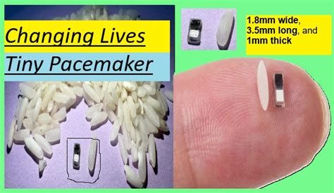 Current Affairs The Tiny Pacemaker