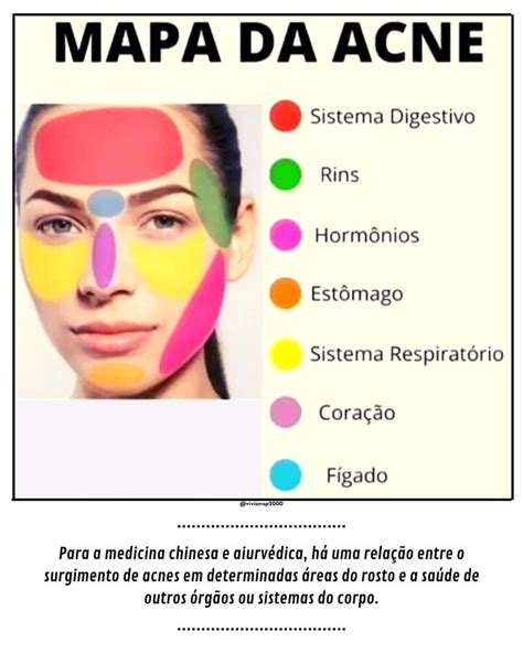 Mapa Da Acne Skin Care Solutions Skin Care Skin