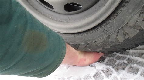 Hand Smashed Harshly Under Heavy Truck
