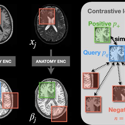 A Learning Anatomical Representation Based On Contrastive Learning