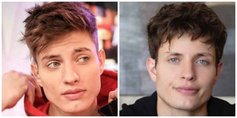 Has Matt Rife Had Plastic Surgery Longevita
