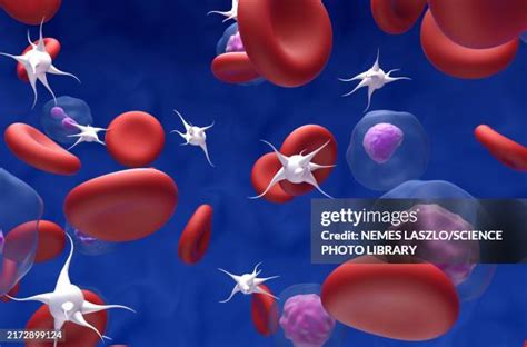 Polycythaemia Vera Blood Cancer Illustration Illustrazione Stock