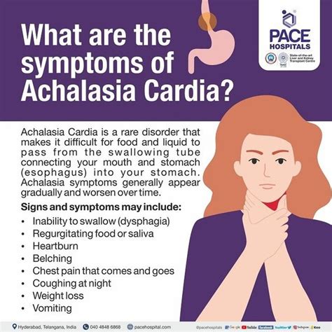 Esophageal Achalasia Wikipedia