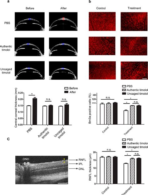 Daylight Mediated Passive And Sustained Release Of The Glaucoma Drug