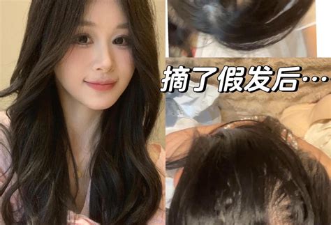 泸州市江阳区华阳街道社区卫生服务中心脂溢性脱发专家【预约挂号图文问诊电话问诊】 京东健康互联网医院