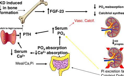 Renal Osteodystrophy Pathogenesis Hyperparathyroidism In Chronic