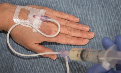 Intravenous Sedation