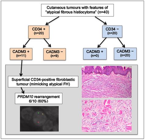 Clinicopathologic And Molecular Study Of Superficial Cd34‐positive