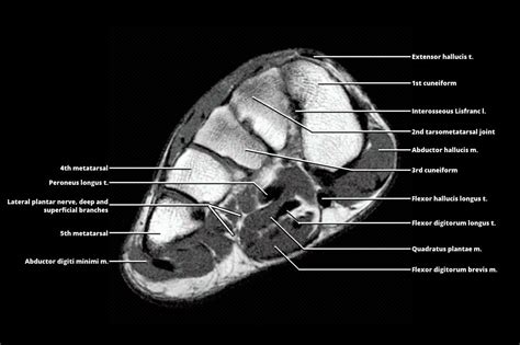 Foot Anatomy Mri Foot Priority Diagnostics